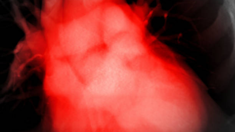 9 Amazing Benefits of Embolization | Image Guided Surgery